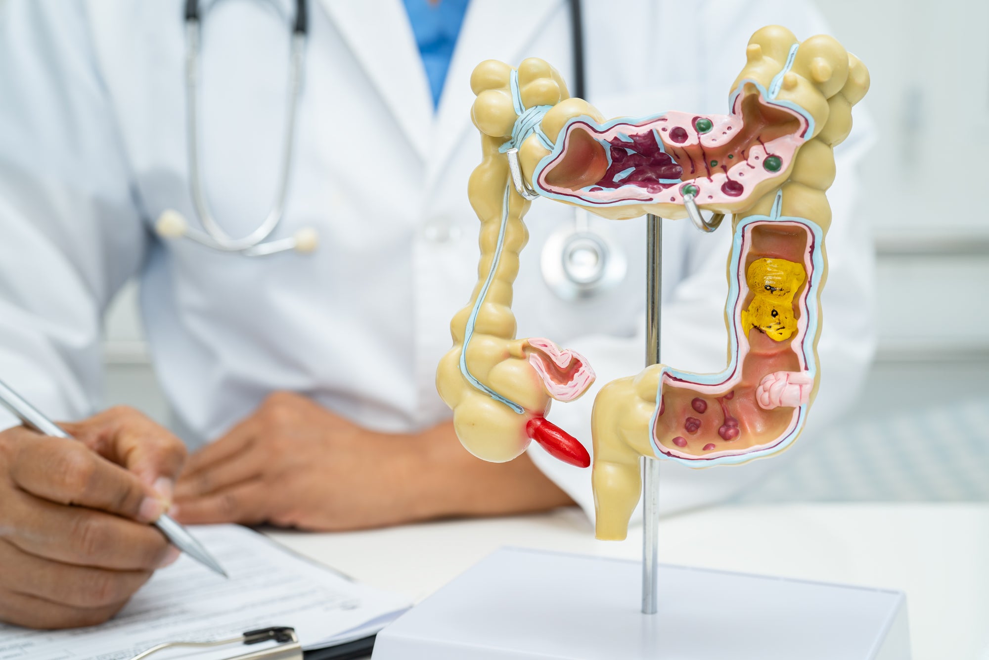 Consumo de alcohol: Cómo afecta a nuestra flora intestinal – Balanfood